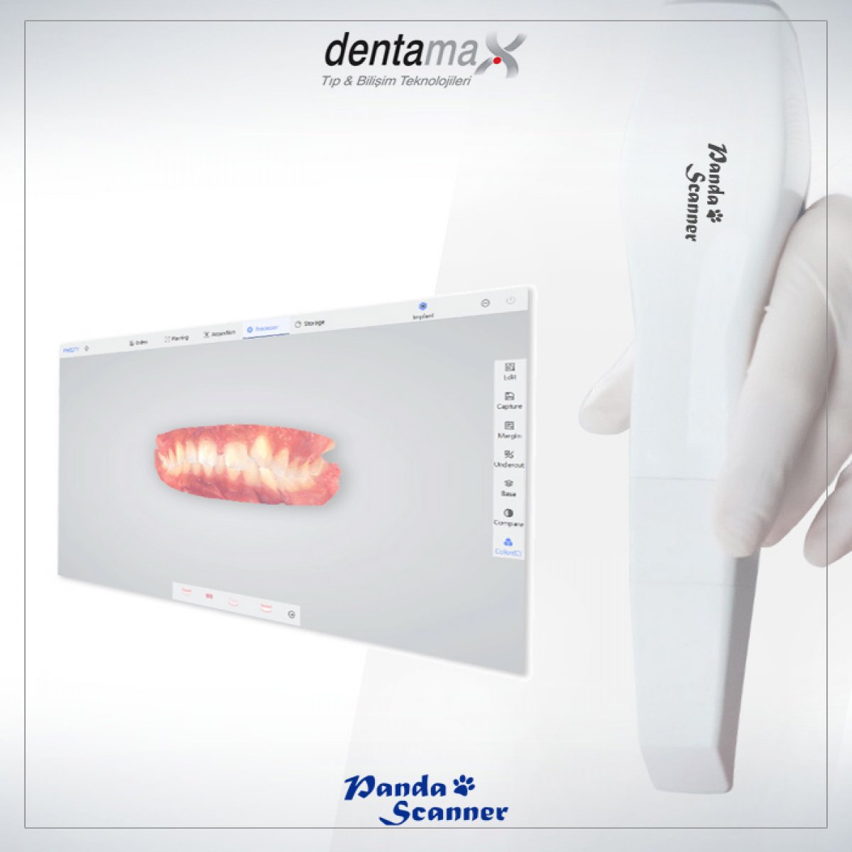 PANDA SCANNER - Dental Tarayıcı, Scanner, Dentamax Diş İstanbul